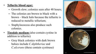 Study of important properties, pathogenicity and laboratory diagnosis ...