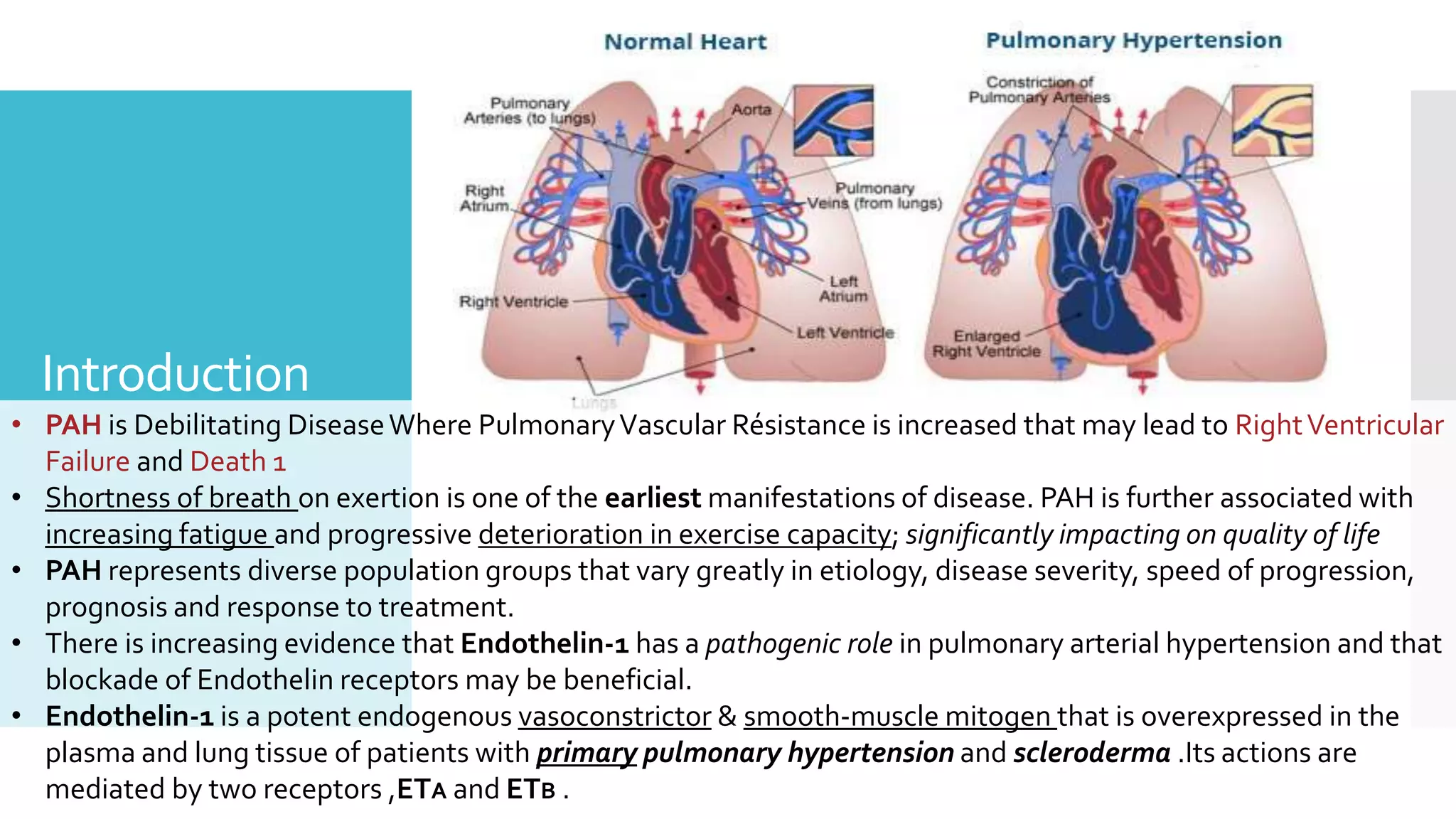Study review (Bosentan) | PPT