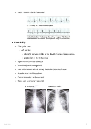 study sheat of mitral steosis lecture 3 of cardiac diseases.pdf