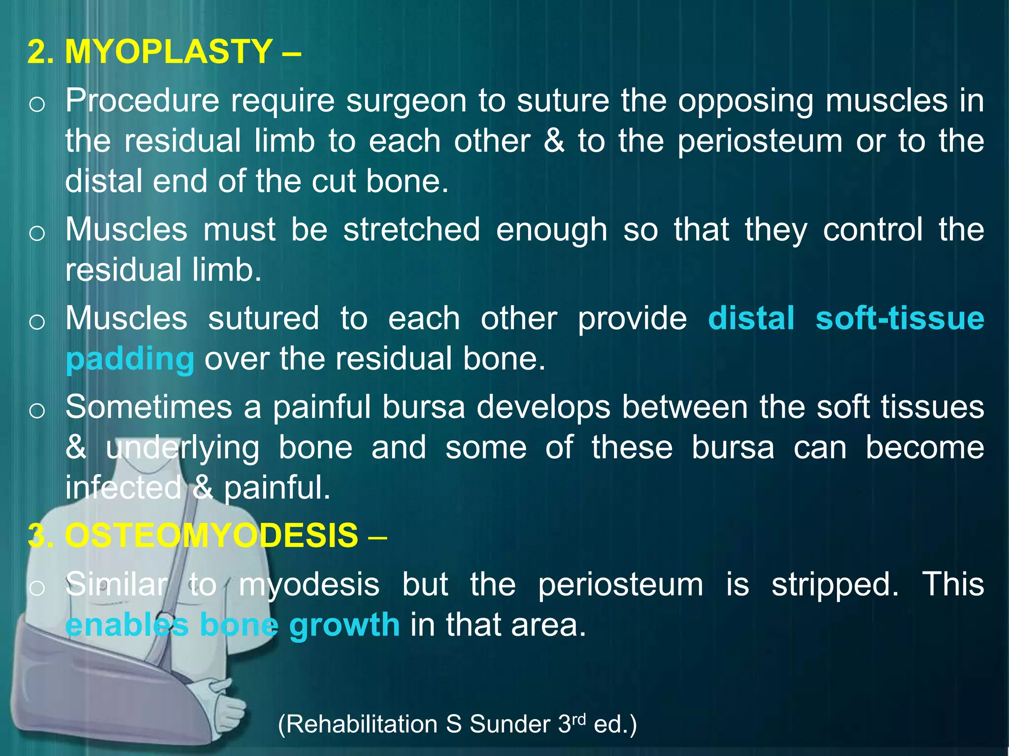 Amputation,Stump care, phantom limb pain and gait training in lower ...