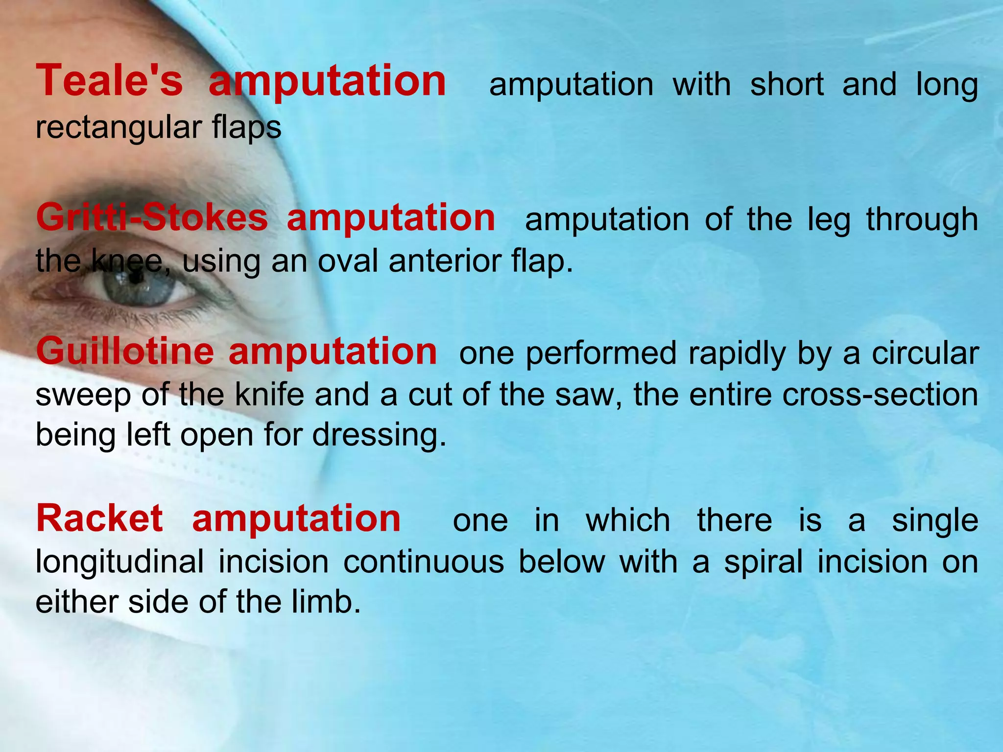Amputation,Stump care, phantom limb pain and gait training in lower ...