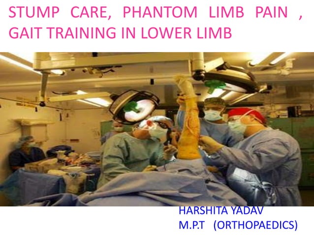 Amputation,Stump care, phantom limb pain and gait training in lower ...