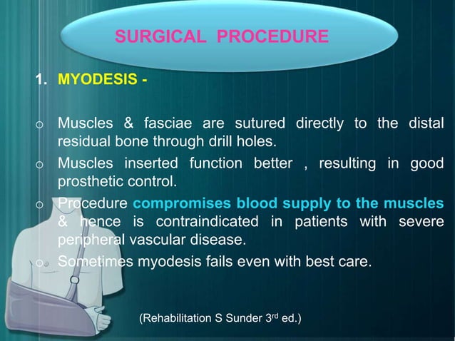 Amputation,Stump care, phantom limb pain and gait training in lower ...