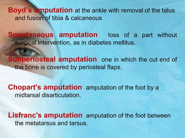 Amputation,Stump care, phantom limb pain and gait training in lower ...