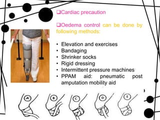 Amputation,Stump care, phantom limb pain and gait training in lower ...