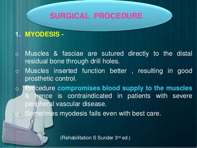 Amputation,Stump care, phantom limb pain and gait training in lower l…
