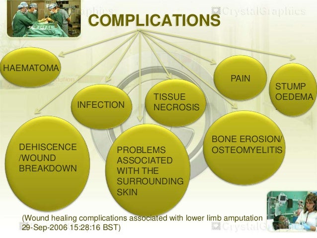 Amputation,Stump care, phantom limb pain and gait training in lower l…