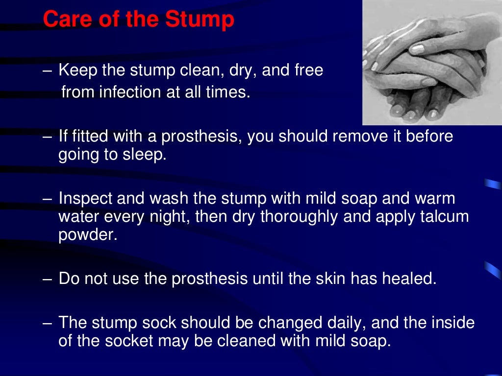 Amputation,Stump care, phantom limb pain and gait training in lower l…