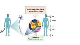 Stunnox in Hyperhidrosis.pptx