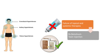 Stunnox in Hyperhidrosis.pptx