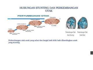 STUNTING dr Fitriah.pptx