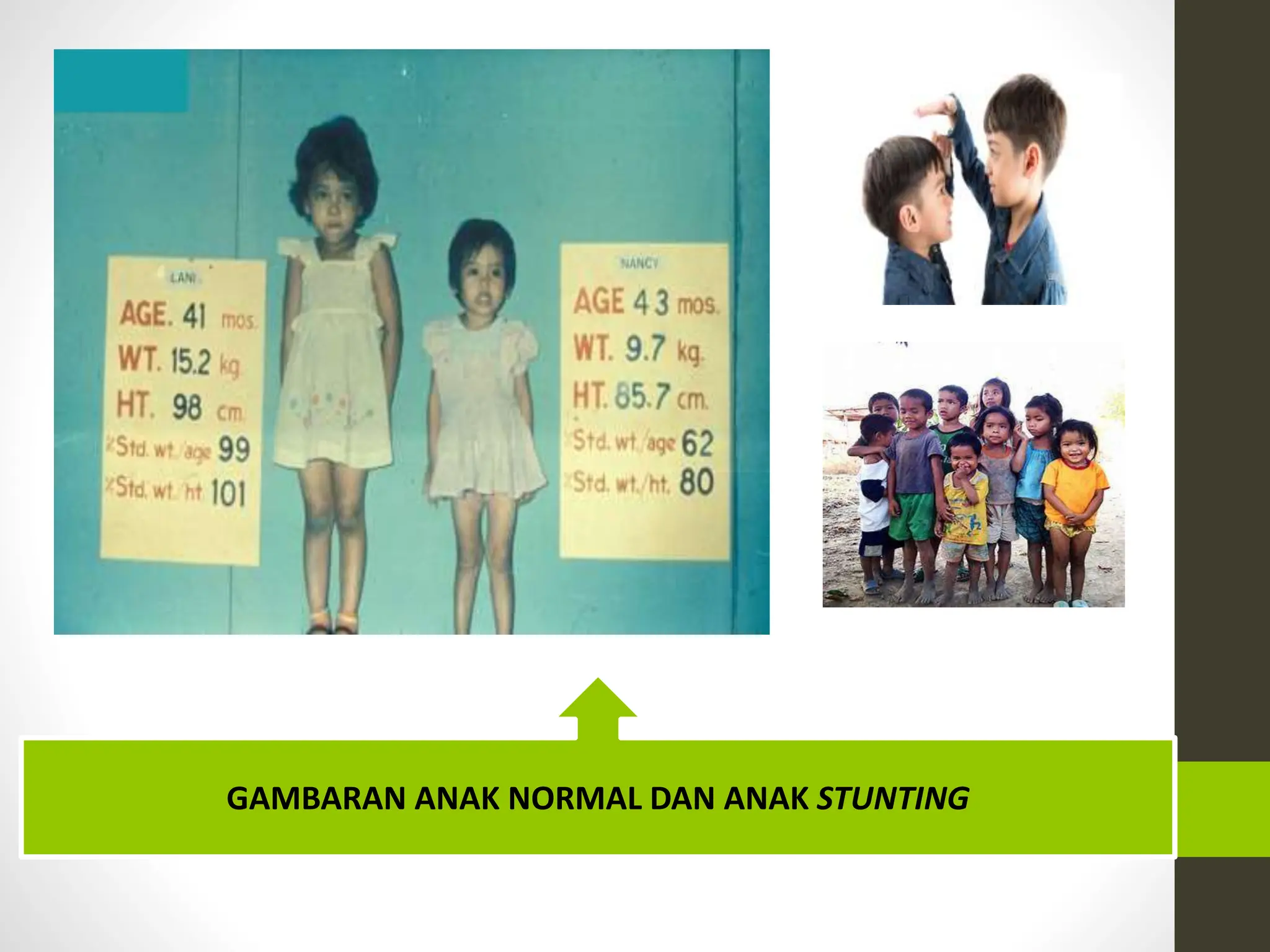 pencegahan dan penanganan stunting .pptx