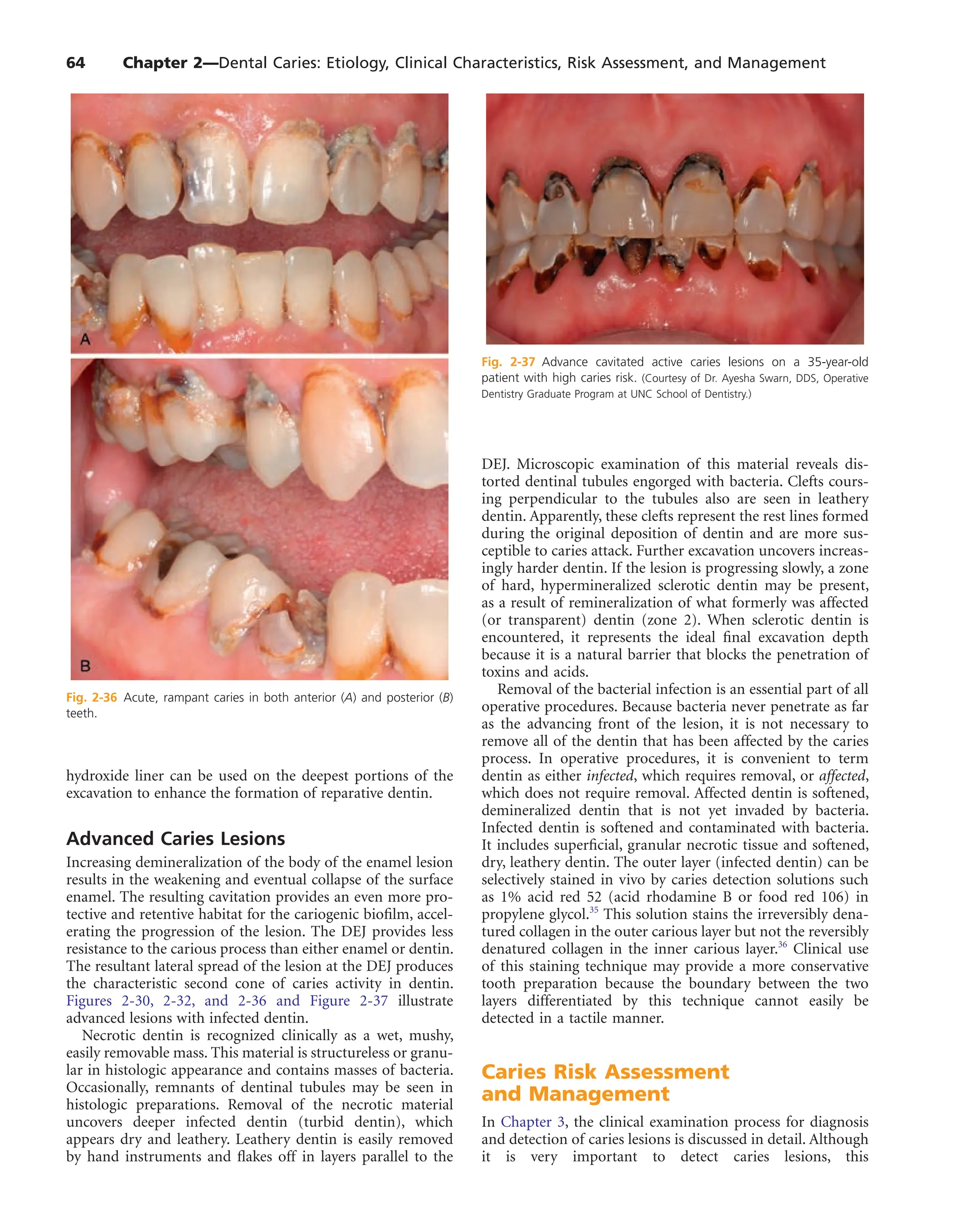 Sturdevant Art and Science of Operative Dentistry.pdf