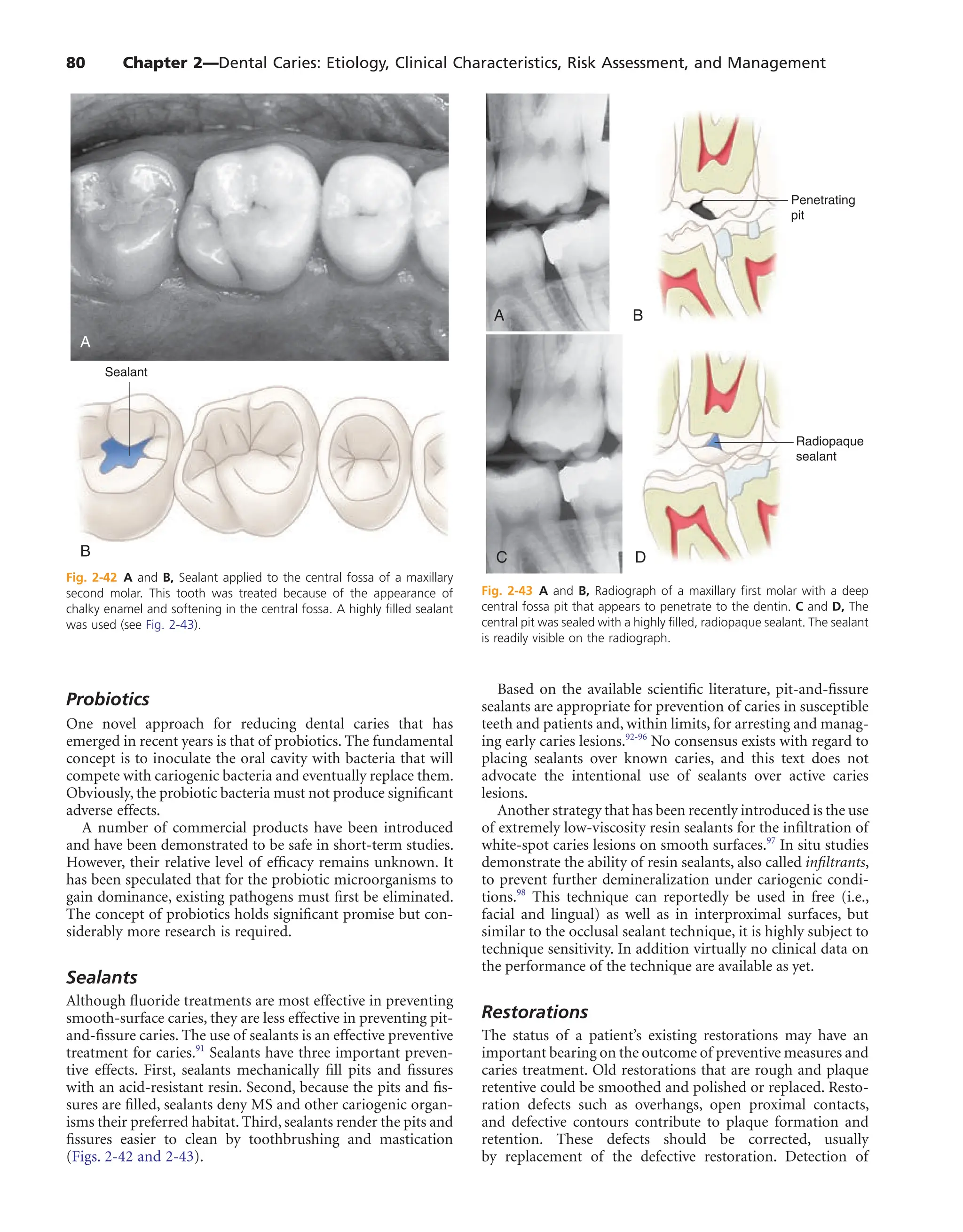 Sturdevant Art and Science of Operative Dentistry.pdf