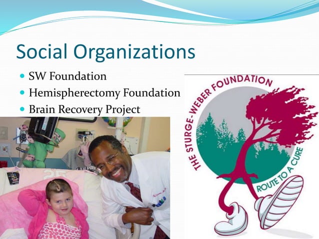 Sturge weber syndrome | PPTX