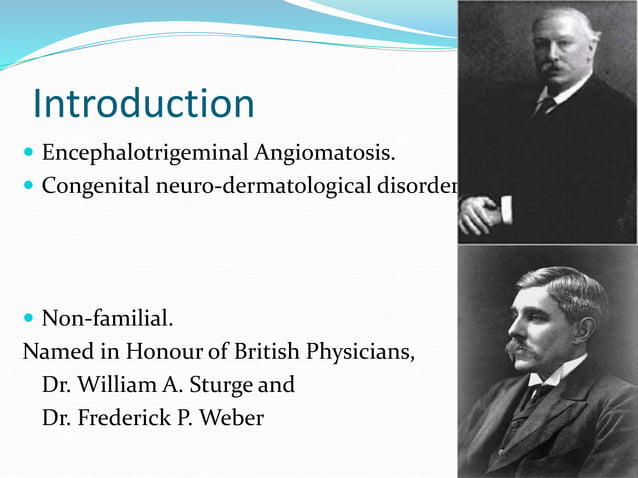 Sturge weber syndrome | PPTX