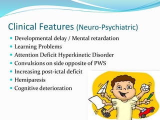 Sturge weber syndrome | PPTX