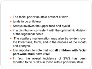 Sturge weber syndrome | PPTX