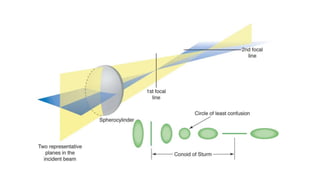 Sturm's Conoid | PPTX