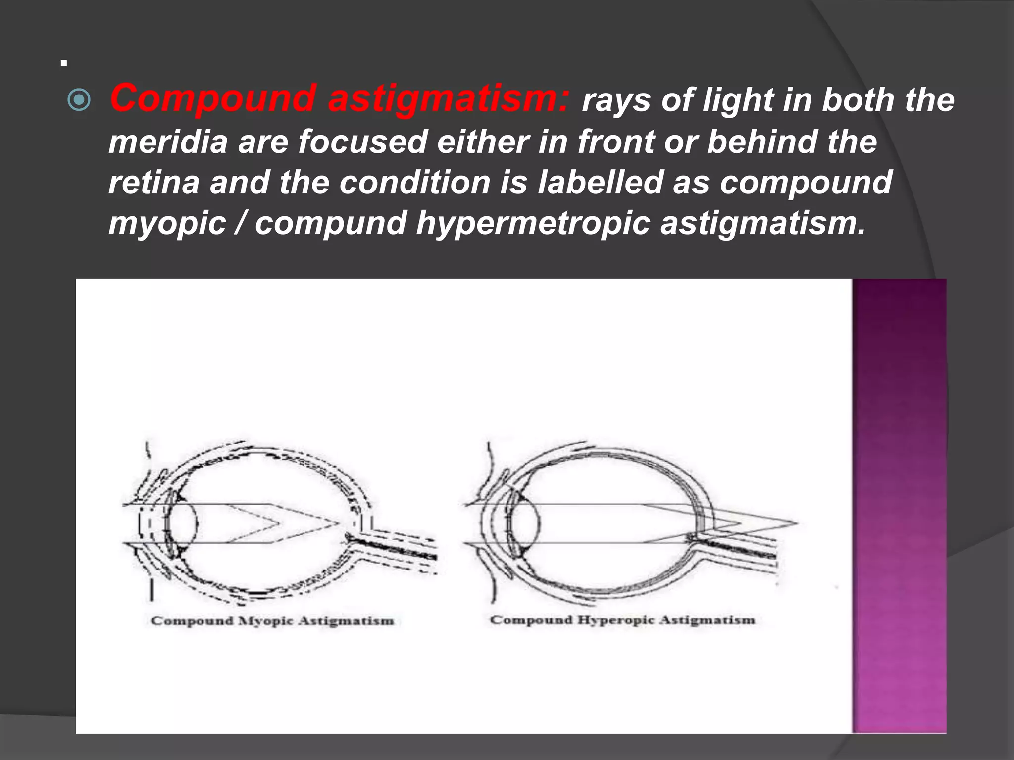 Sturm's conoid | PPTX