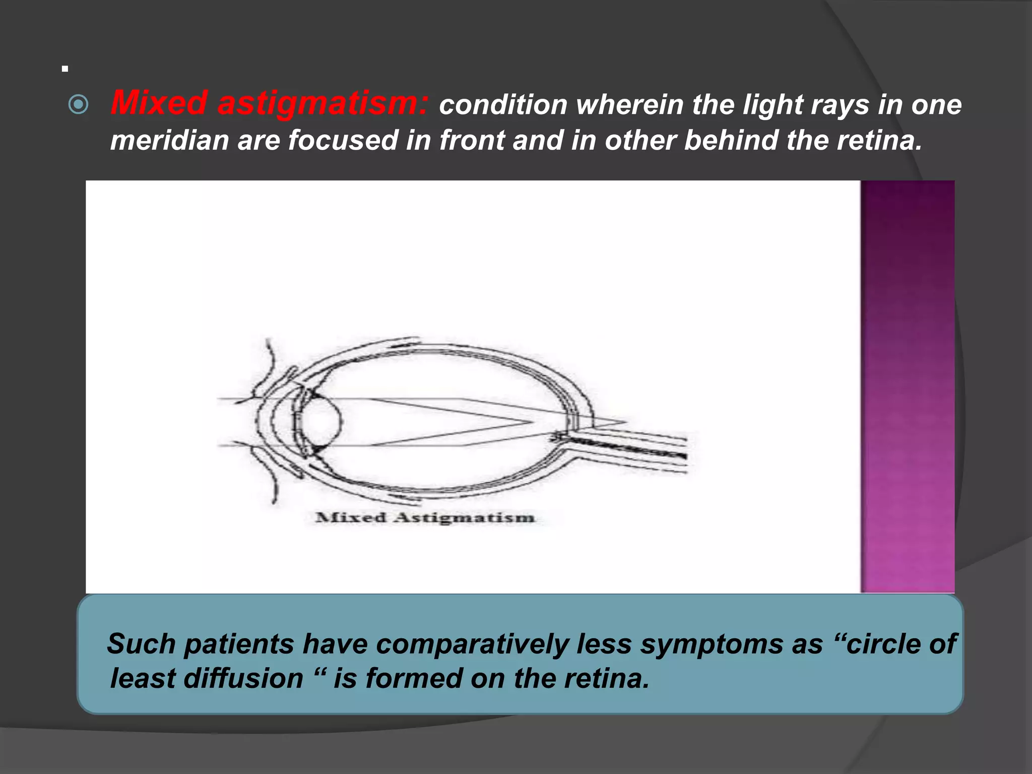 Sturm's conoid | PPTX