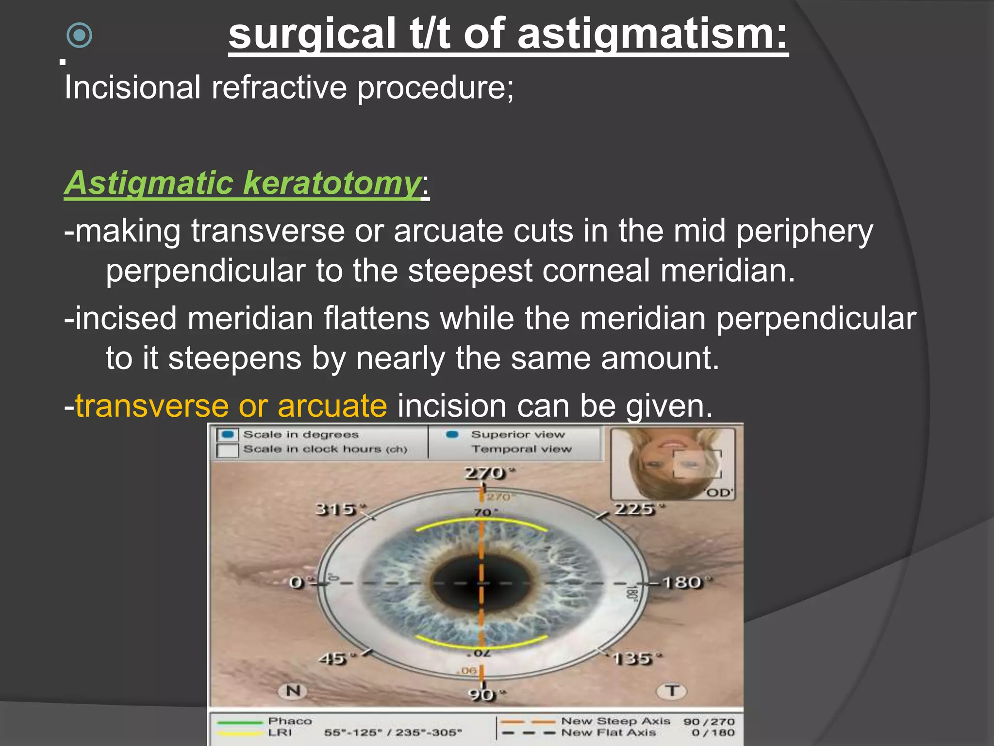 Sturm's conoid | PPTX