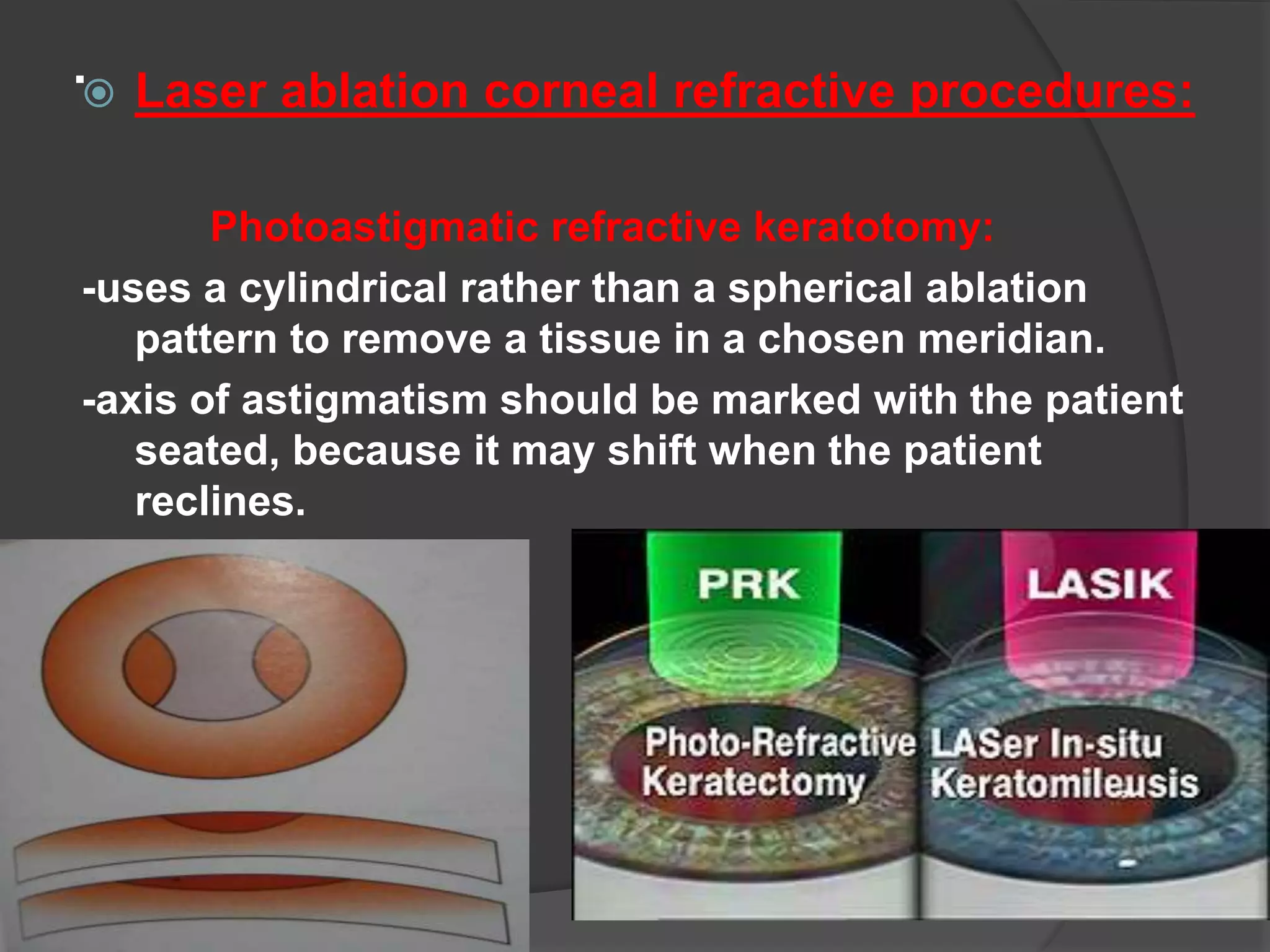 Sturm's conoid | PPTX