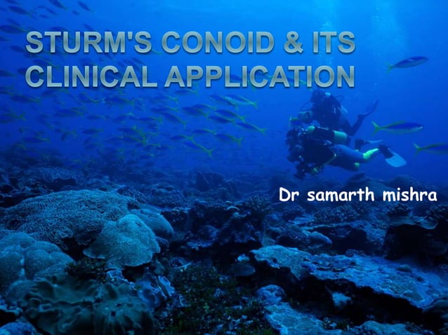 Sturm's conoid | PPTX | Eye and Vision Conditions | Diseases and Conditions