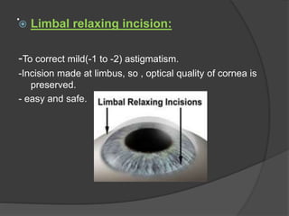 Sturm's conoid | PPTX