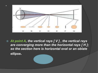 Sturm's conoid | PPTX