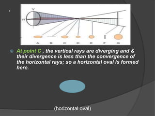 Sturm's conoid | PPTX