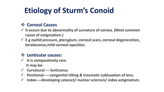 Sturm's Conoid ppt | PPTX