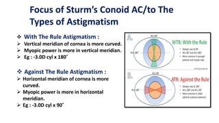 Sturm's Conoid ppt | PPTX