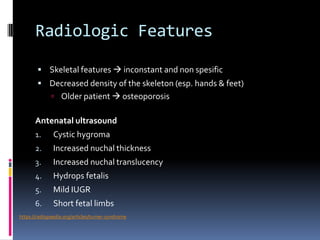 Turner's Syndrome | PDF