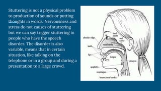 Stuttering and stammering | PPTX