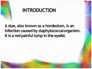 Stye or hordeolum | PPTX