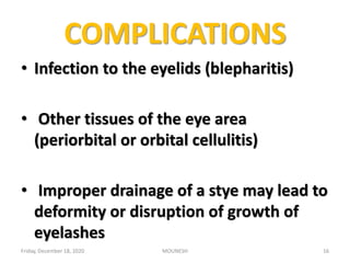 Stye & chalazion | PPTX