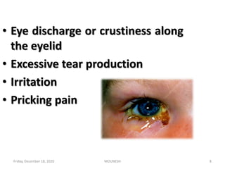 Stye & chalazion | PPTX