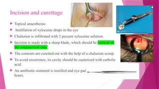 Stye, CHALAZION, Internal hordeolum.pptx