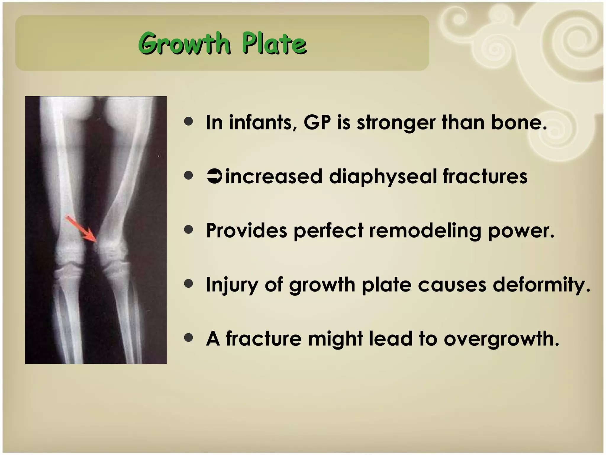 Paediatric fracture | PPT