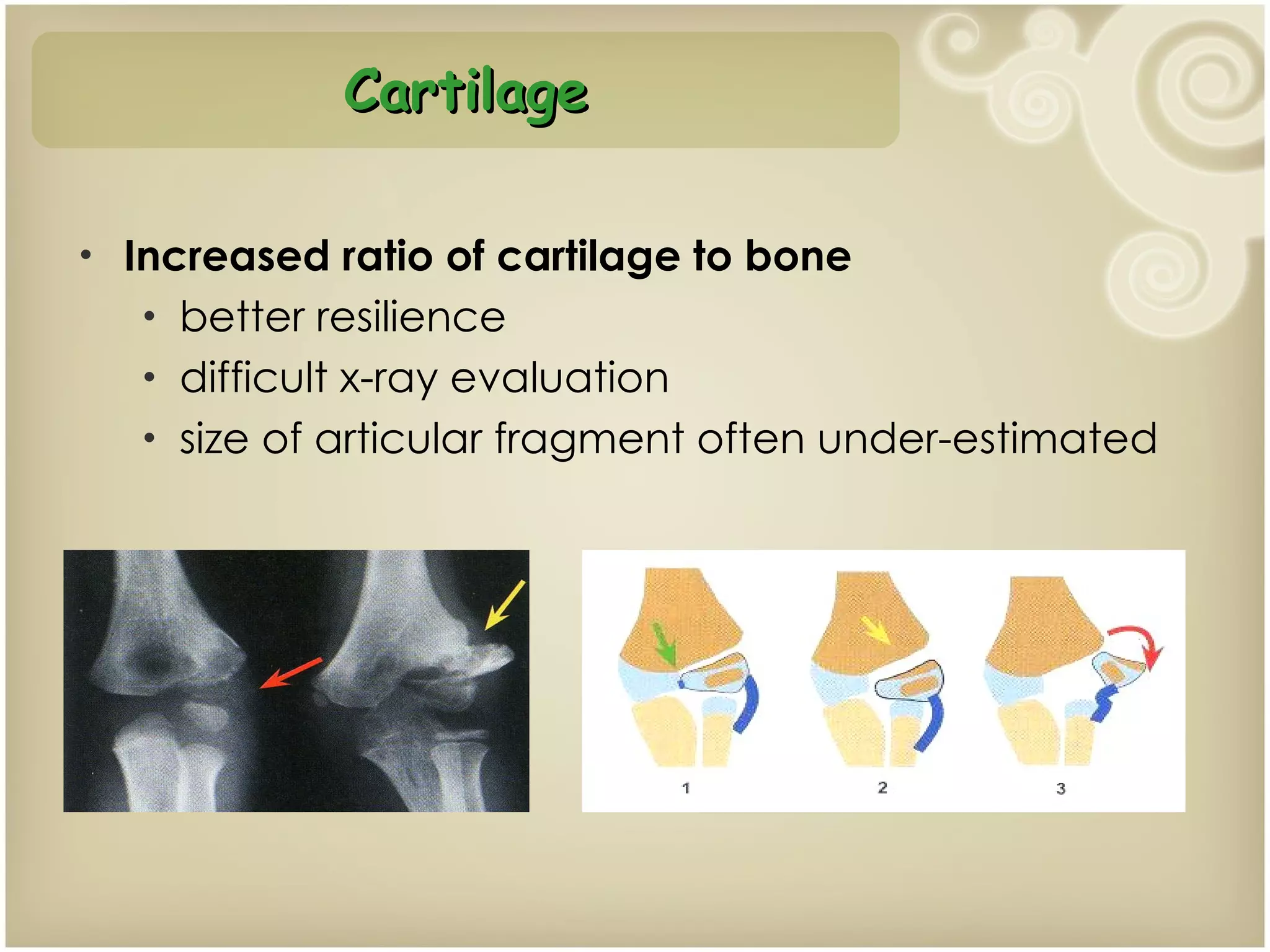 Paediatric fracture | PPT