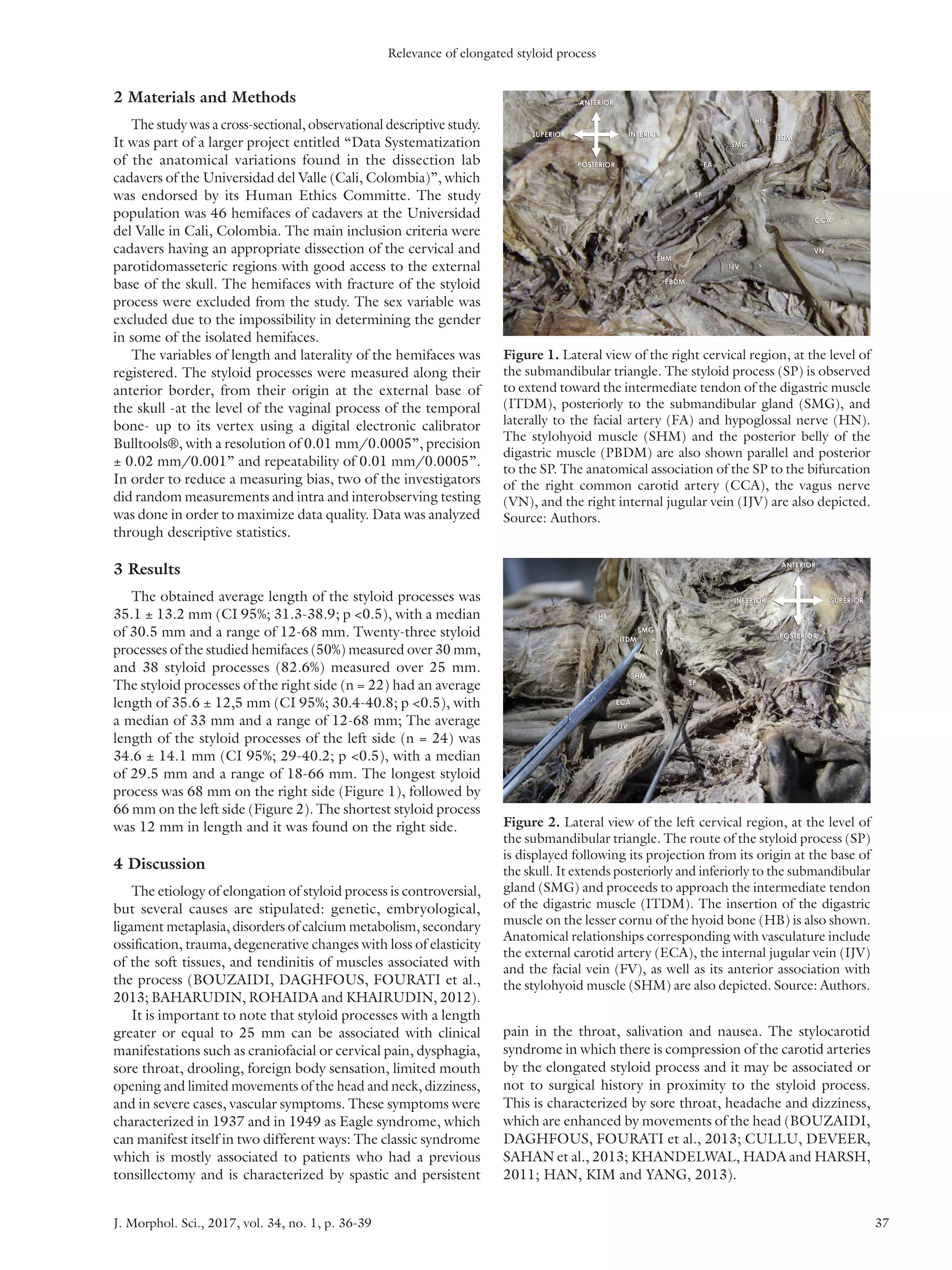 Styloid process | PDF