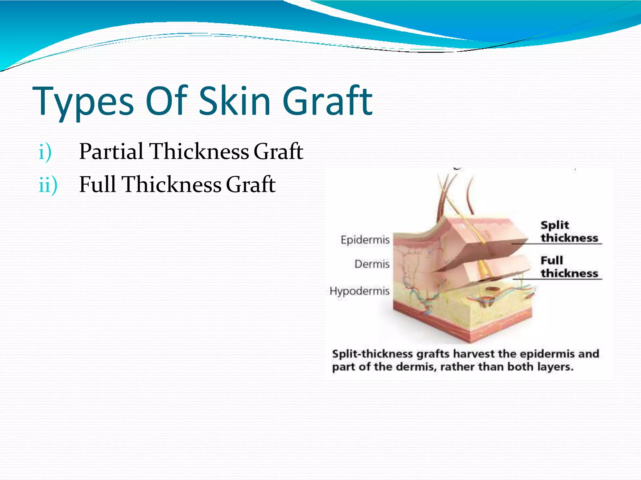 Skin_Graft_.pptx