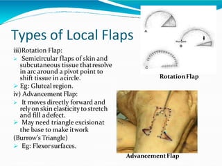 Skin_Graft_.pptx | Skin and Dermatology | Diseases and Conditions