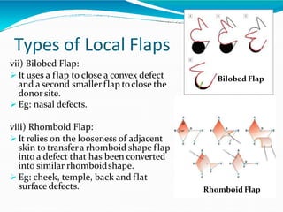Skin_Graft_.pptx | Skin and Dermatology | Diseases and Conditions