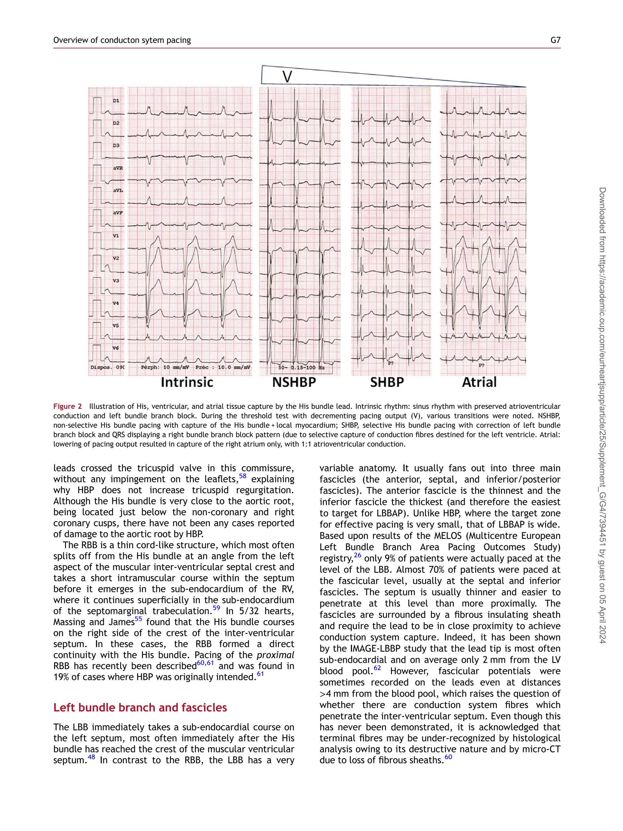 Suad114 Pdf Pacing Conduction System Pacing Pdf