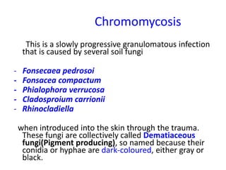 Sub cutaneous fungal infections for mbbs students | PPTX
