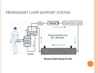 Sub acute hepatic failure | PPT