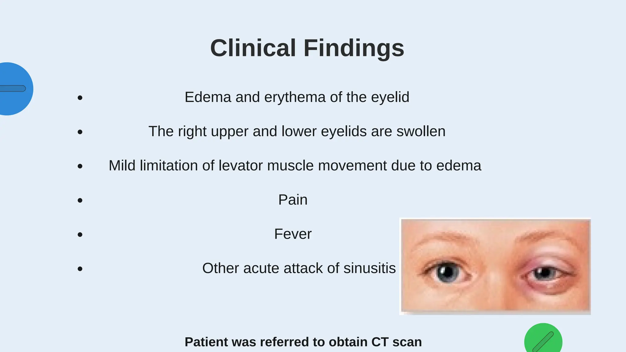 Preseptal cellulitis case presentation.. | PDF