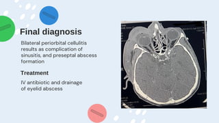 Preseptal cellulitis case presentation.. | PDF
